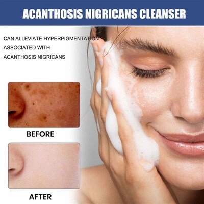Removing Cleanser Moisturizing Brightening Skin Pores Tone