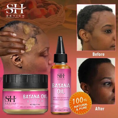 Natural Pure Batana Oil For Hair Growth Butter Hair Mask