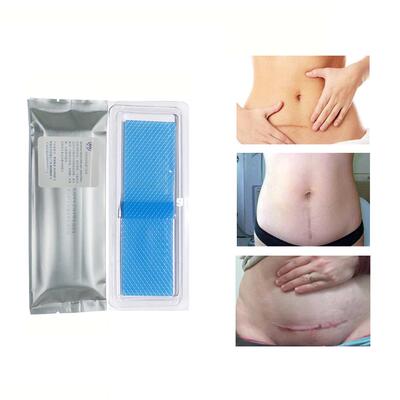 1Pc Caesarean Section Surgery Silicone Gel Removal Scar Shee