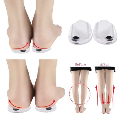 2PCS Insoles Correction Shoe Inserts Pads Effective O/X Type