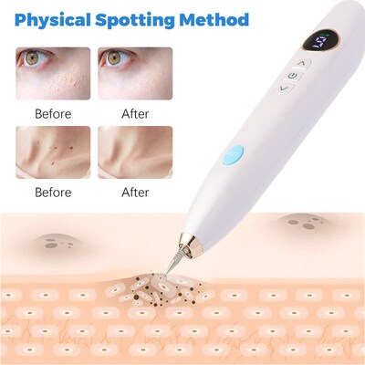 Skin Tag Remover Warts Eliminator Lcd Plasma Pen Papillomas