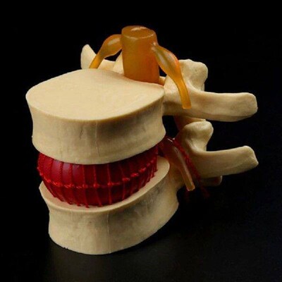 Lumbar Vertebrae Model Anatomical Spine Lumbar Disc