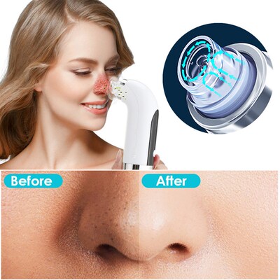 Blackhead Remover Vacuum Suction Rechargeable Small Bubble B