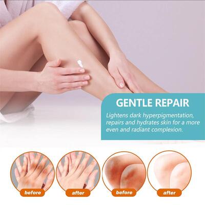 Underarm Whitening Creams For Dark Skin Lightening Body Crot