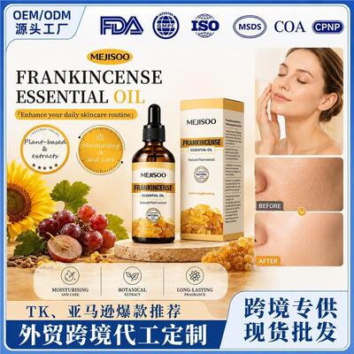 外贸Frankincense Essential Oil身体护理乳香精油