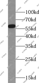 FineTest一抗 Phospho-Akt(Ser473)抗体,RAC antibody,磷酸化抗体