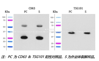 umibio®外泌体CD63&TSG101蛋白检测试剂盒,适用外泌体蛋白检测WB