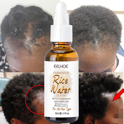 WaterHairGrowthSerum护发油