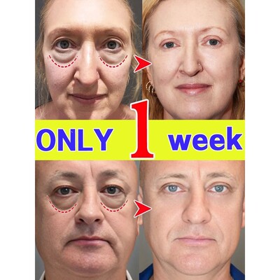 Eye Bags Cream Remove Eyes Wrinkle