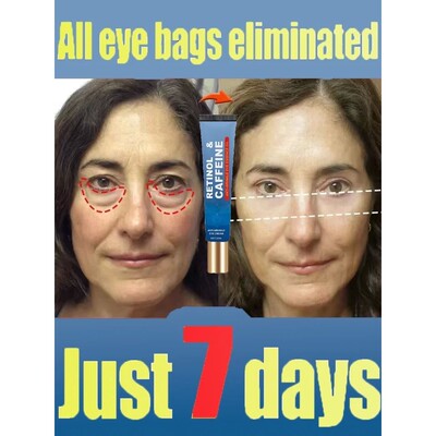 Anti wrinkle eye cream eliminates dark circles fades fine li
