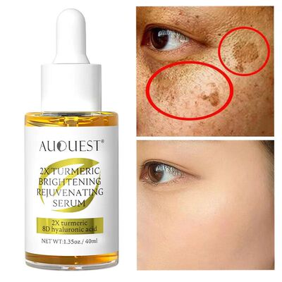 Dark Spot Serum Hyaluronic Acid Whitening Vitamin C Face Ser