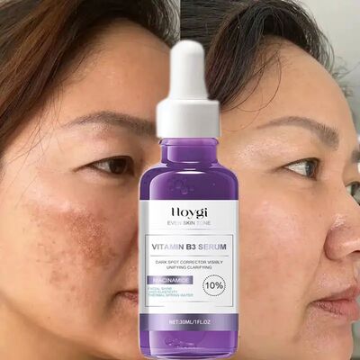Powerful Dark Spots Remover Freckle Whitening Serum Melanin