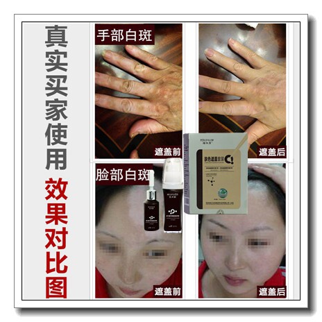 正品外用祛持久白殿风药膏防水型遮盖液白斑净去遮瑕笔防汗防油霜