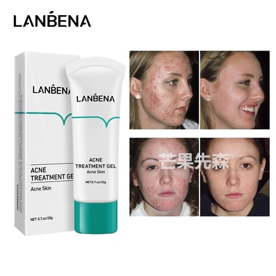 LANBENA 蓝蓓娜 凝胶ACNE TREATMENT GEL青春痘祛粉刺 LA-122
