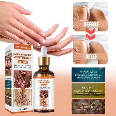 WestMonth 关节去黑美肤护理液 膝盖脚踝提亮肤色滋润淡化黑色素