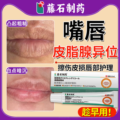 【藤石制药】嘴唇白点唇部护理膏