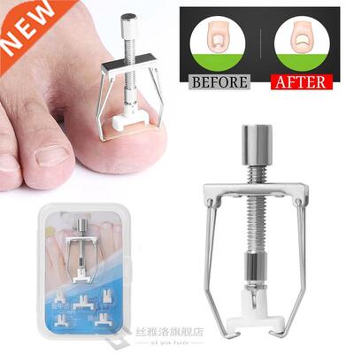 *Ingrown Toe Nail Correction Lifter Pedicure Toenail Fixer R