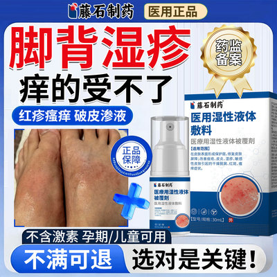 藤石制药脚背湿疹瘙痒脚上水泡止痒去真菌感染脚癣脚面痒喷雾剂CA