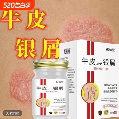 【官方正品】卡泊三淳倍他米软膏银屑专用膏牛皮涂抹膏手足止痒膏