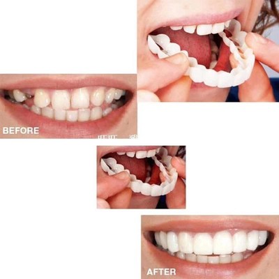 Veneers Teeth Comfort Fit Flex Cosmetic Wear resistance Teet
