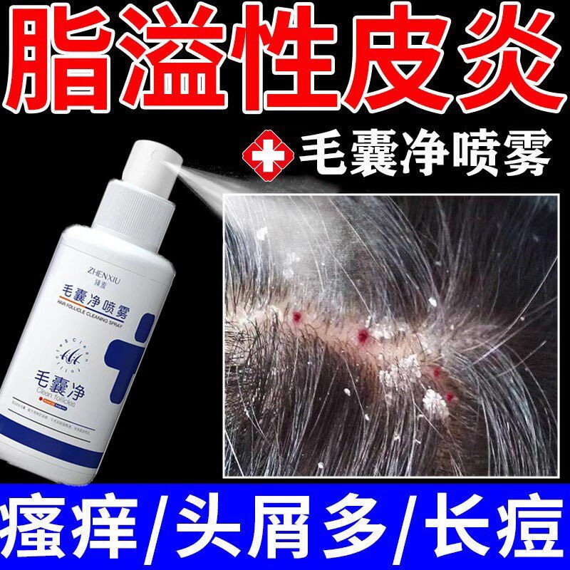 臻羞毛囊净喷雾清洁头皮发丝护发养发液去头屑精华毛囊营养液补水