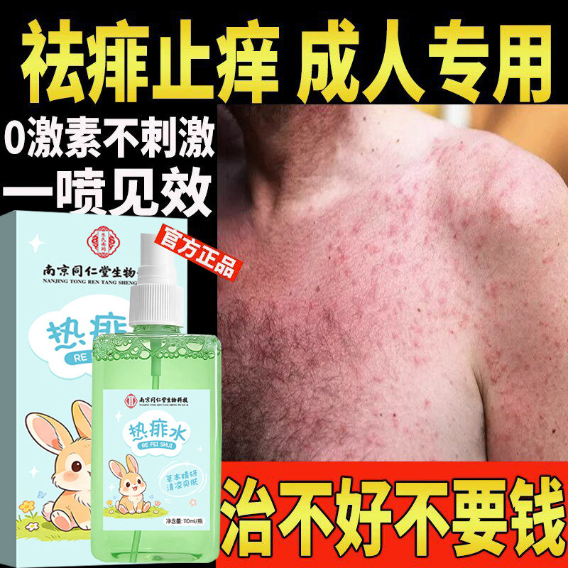 成人儿童痱子水去身上红疙瘩痱子痒全身适用防蚊虫叮咬热痱水喷雾