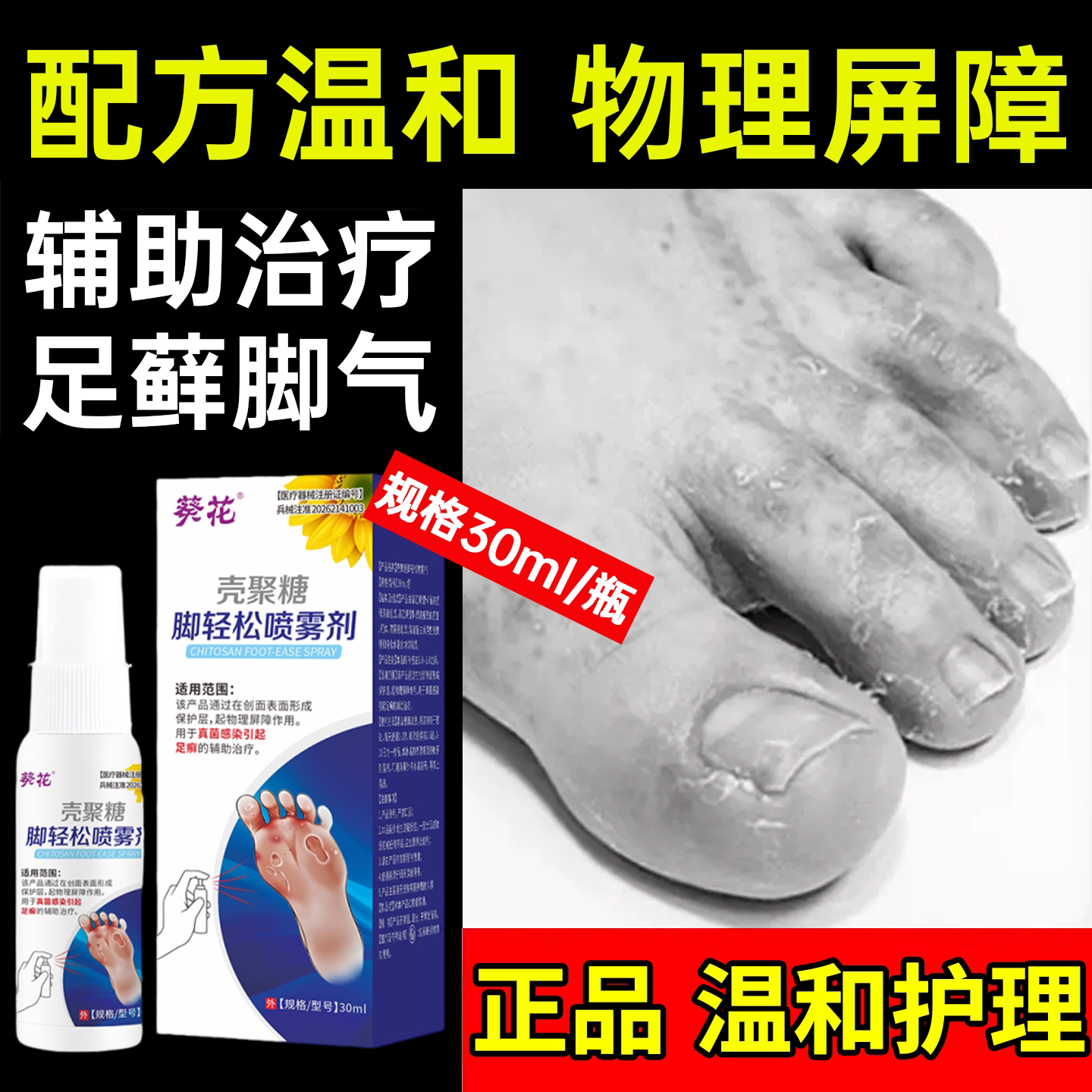 葵花壳聚糖脚喷雾剂脚气止痒脱皮杀菌真菌感染出汗孕妇哺乳期可用