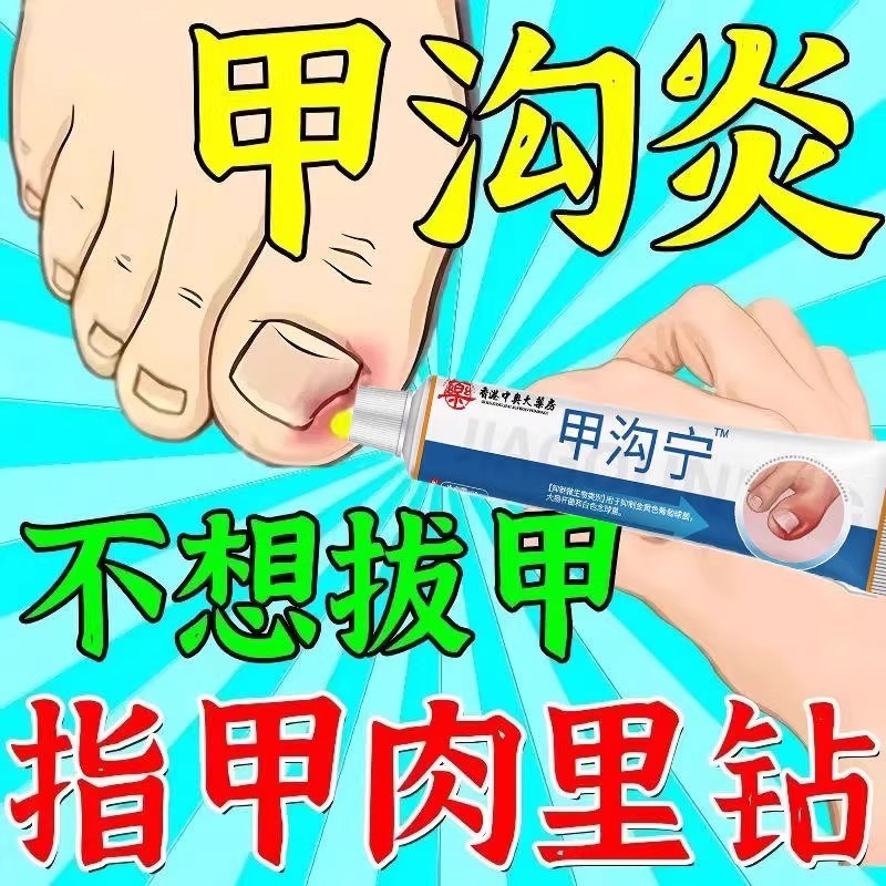 脚趾红肿热痛甲沟修护膏指甲长倒刺改善甲床软化嵌甲指甲修护乳霜