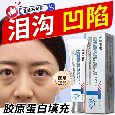 泪沟凹陷胶原蛋白填充修复