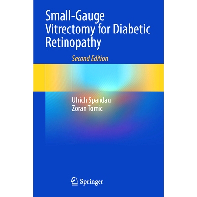 预订 Small-Gauge Vitrectomy for Diabetic Retinopathy: 9783031262067