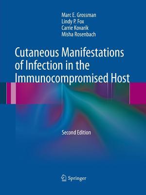 【预订】Cutaneous Manifestations of Infection in the Immunocompromised Host