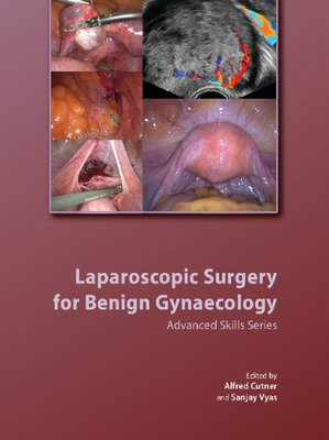 【预订】Laparoscopic Surgery for Benign Gynaecology Hardback with DVDs