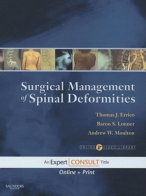 【预售】Surgical Management of Spinal Deformities