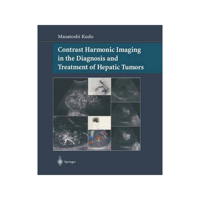 预订 Contrast Harmonic Imaging in the Diagnosis and Treatment of Hepatic Tumors