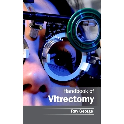 预订 Handbook of Vitrectomy 玻璃体切除术手册: 9781632412478