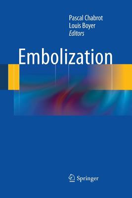 【预订】Embolization