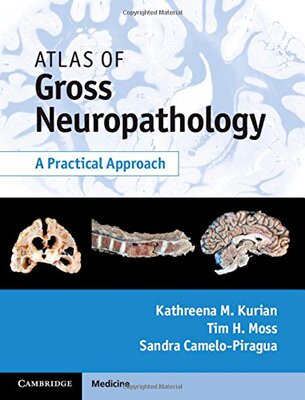 【预订】Atlas of Gross Neuropathology Book and Online Bundle
