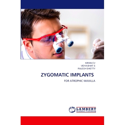 预订 Zygomatic Implants: 9783659761492