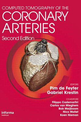 【预订】Computed Tomography of the Coronary Arteries, Second Edition