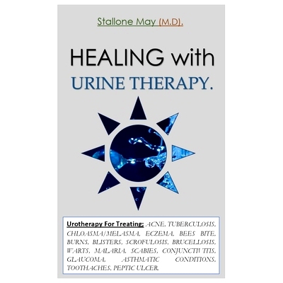 预订 HEALING with URINE THERAPY.: Urotherapy For Treating; ACNE, TUBERCULOSIS, CHLOASMA/MELASMA, ECZEMA, BEES BITE, BURN
