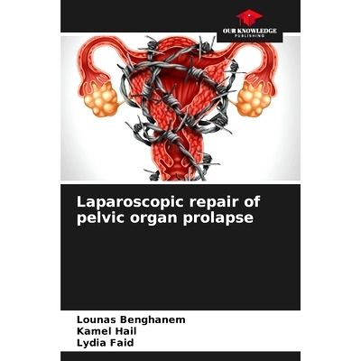 预订 Laparoscopic repair of pelvic organ prolapse: 9786207711482