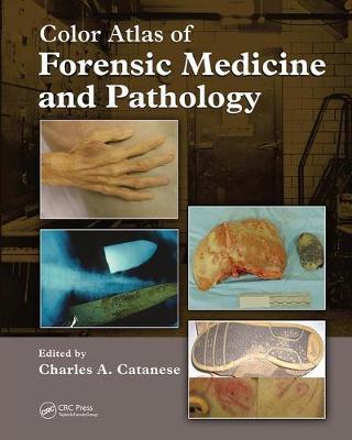 【预订】Color Atlas of Forensic Medicine and Pathology