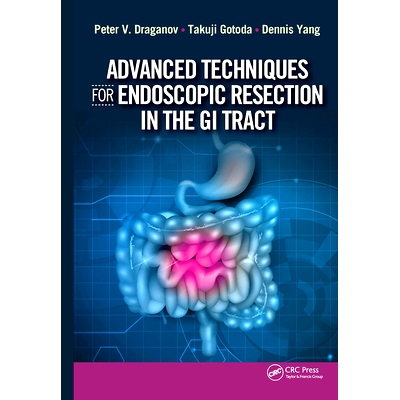 预订 Advanced Techniques for Endoscopic Resection in the GI Tract 胃肠道内切除术的先进技术: 9781630914592