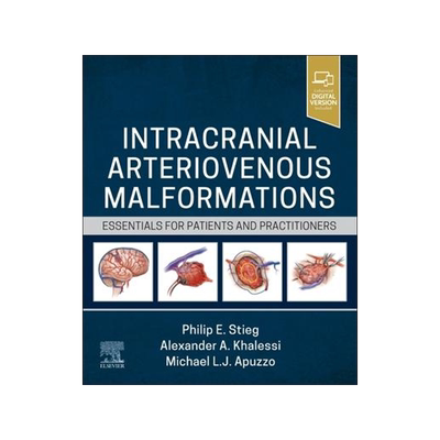 [预订]Intracranial Arteriovenous Malformations 9780323825306