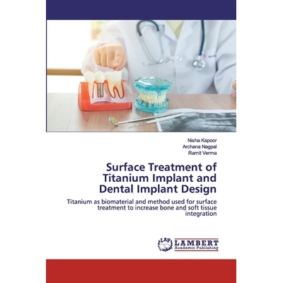 预订 Surface Treatment of Titanium Implant and Dental Implant Design: 9786202556385