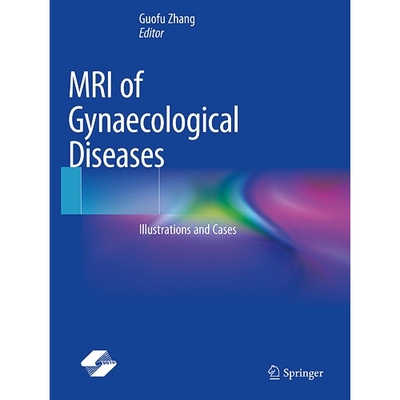 预订 MRI of Gynaecological Diseases Illustrations and Cases 妇科疾病MRI检查：图例与病例 9789819936465