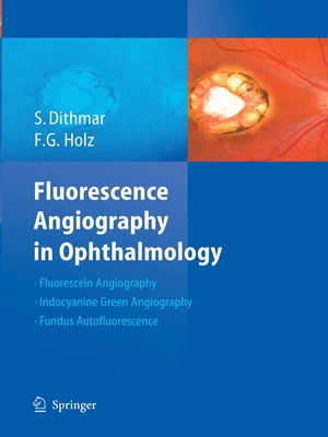 【预订】Fluorescence Angiography in Ophthalmology