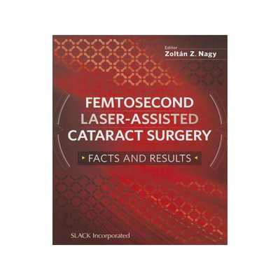 [预订]Femtosecond Laser-Assisted Cataract Surgery 9781617119965