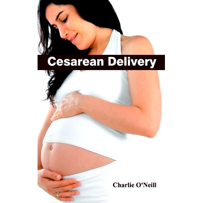 预订 Cesarean Delivery 剖宫产: 9781632420749