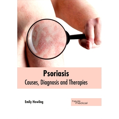 预订 Psoriasis: Causes, Diagnosis and Therapies 牛皮癣：病因，诊断和*: 9781632414359